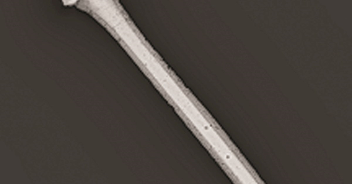 Case: Digital X-ray reveals ancient sword secrets